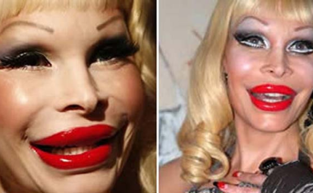 Michaela Romanini Antes Y Después